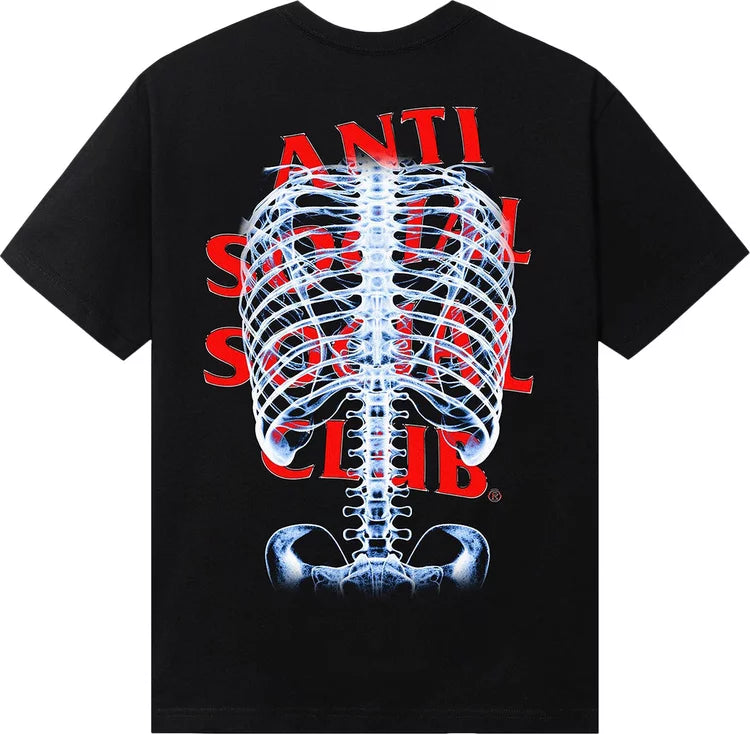 Anti Social Social Club Bones Tee 'Black' – Dawntown